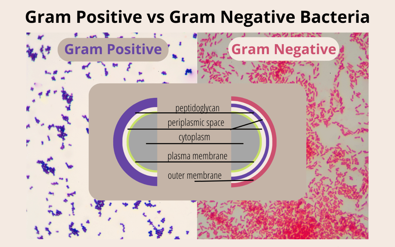 Difference Between Gram-Positive and Gram-Negative Bacteria